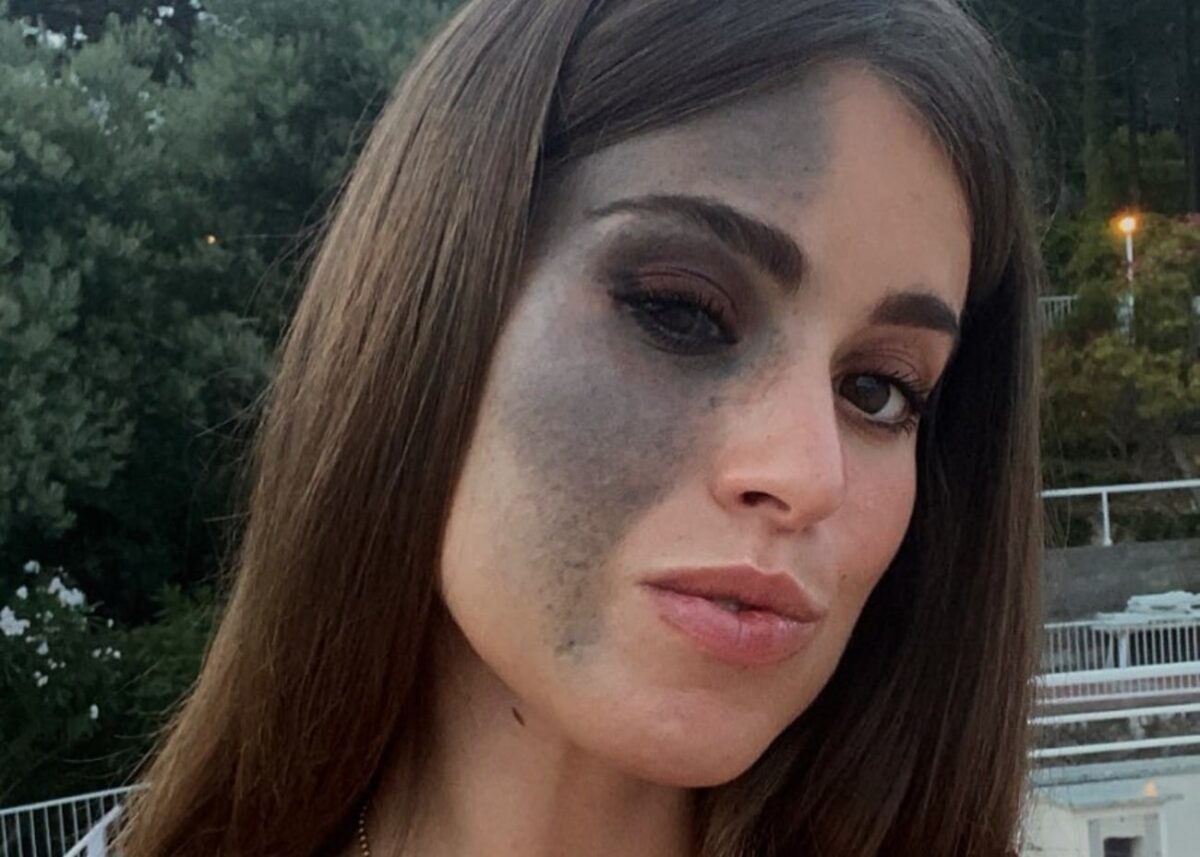 Carlotta Bertotti e il suo nevo di Ota: “Non lo copro più”